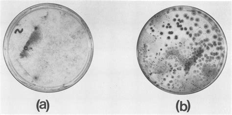 Microbial Growth On Selective Medium And Malt Agar Plates After 3 Days