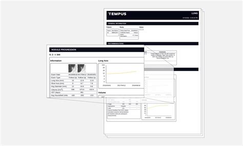 Tempus Pixel Lung Ai Powered Lung Nodule Analysis