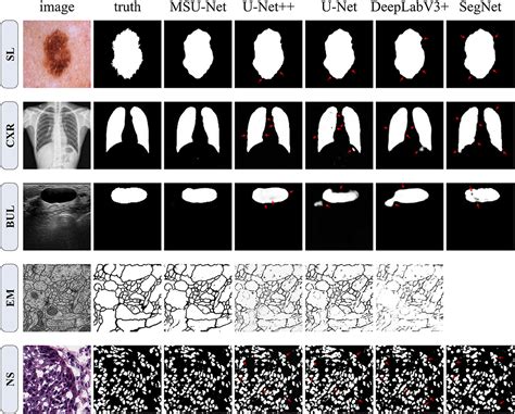 Frontiers Msu Net Multi Scale U Net For 2d Medical Image Segmentation