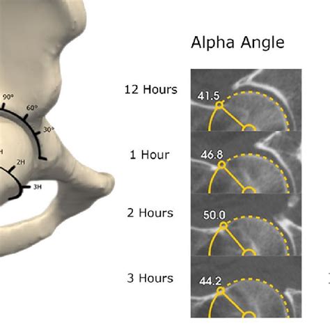 Alpha Angle And Center Edge Angle Measurements Are Shown In Steps Of Download Scientific