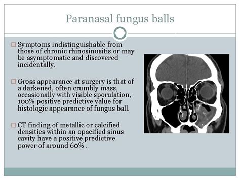Chapter 48 Fungal Rhinosinusitis Fungal Rhinosinusitis Acute Invasive