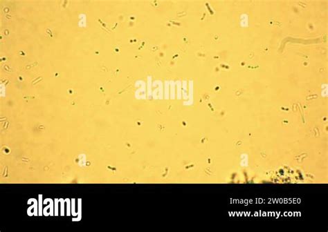 Microscope Lactic Acid Bacteria Stock Videos And Footage Hd And 4k