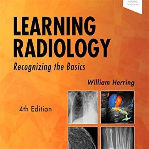 Stream Pdf Download Learning Radiology Recognizing The Basics From