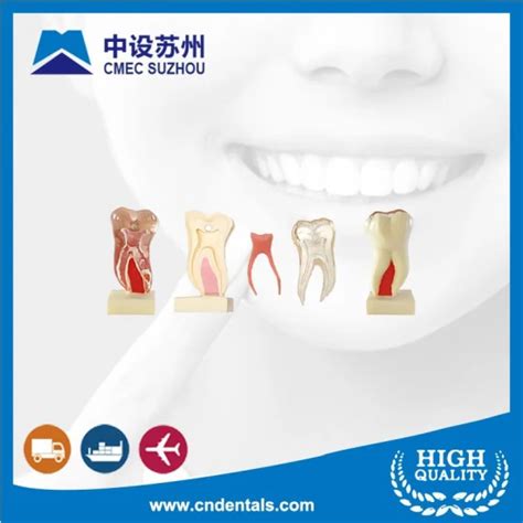 Anatomic Profile Model Of Mandibular Molar Dental Oral Teeth Model