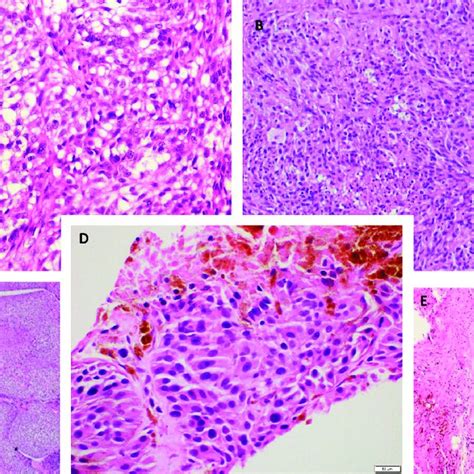 These Are Mainly Examples Of Cytoplasmic Staining Properties A A
