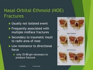 Nasal Orbital Ethmoid Noe Fractures Ppt