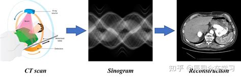 反问题层析重建讨论（inverse Problems For Tomography） 知乎