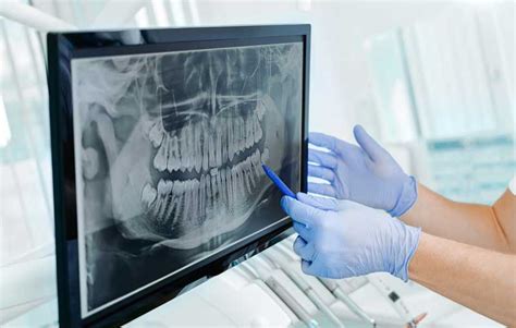Dislodged Tooth Treatment Nyc Advanced Endodontics Care
