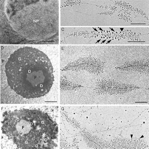 Electron Micrographs Of Nucleoli Together With Corresponding Spread