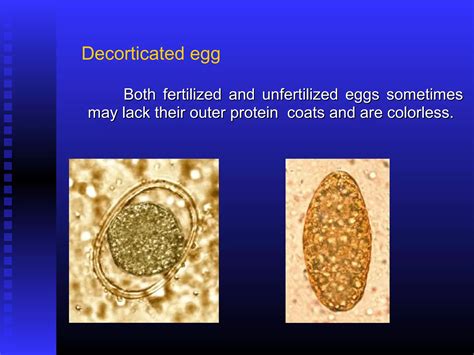 Nematode Ppt
