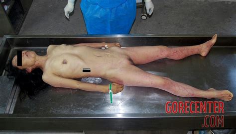 Anatomy Lesson With Gorecenter • Gorecenter