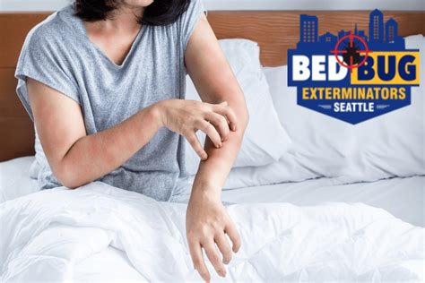 Financialcontent Bed Bug Exterminators Seattle Llc Provides Effective