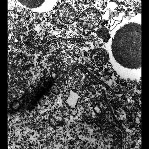 Cil12996 Paramecium Multimicronucleatum Cell By Organism Eukaryotic