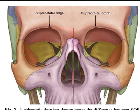 Supraorbital Foramen Semantic Scholar