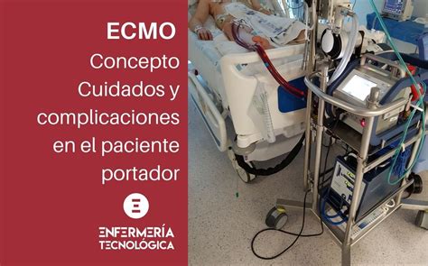 Ecmo Concepto Cuidados Y Complicaciones En El Paciente Portador
