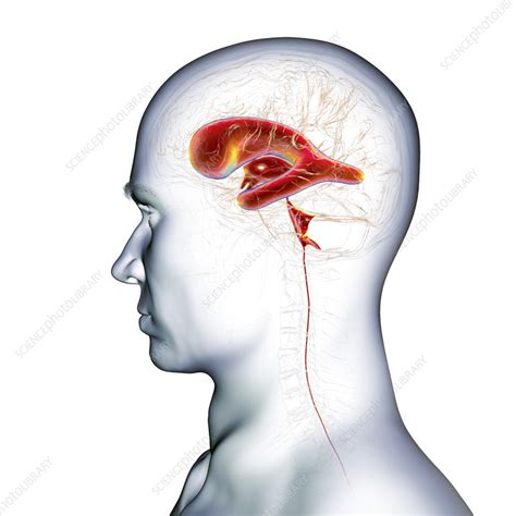 Normal Pressure Hydrocephalus Illustration Stock Image F0459166