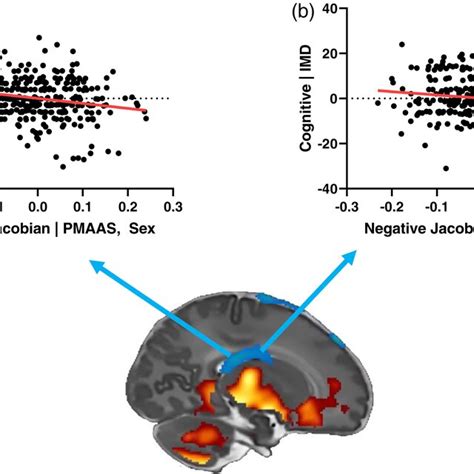Association Of Regional Volumes With Neurodevelopment At 18 Months Download Scientific Diagram