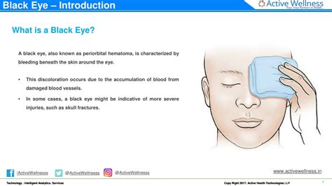 Ppt Black Eye Causes And Treatment Powerpoint Presentation Free