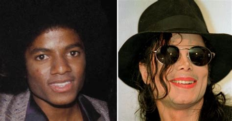 Michael Jackson Nose