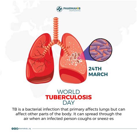 Tuberculosis Tb Is A Bacterial Infection Caused By Mycobacterium