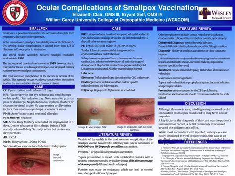 Smallpox Vaccine Stages