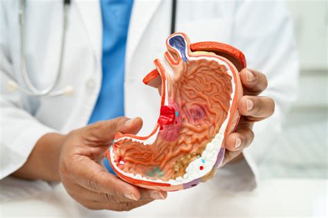 Hydrochloric Acid Stomach Acid Why We Need It