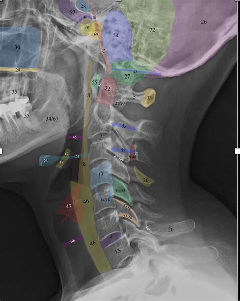 Radiology Lateral View Diagram Quizlet