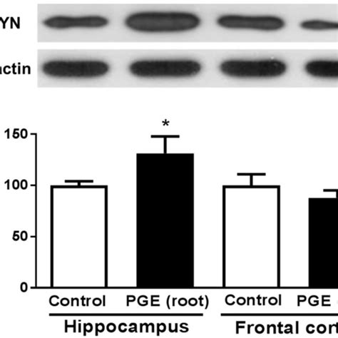 Immunoblotting Analysis Of Synaptophysin Expression In The Hippocampus