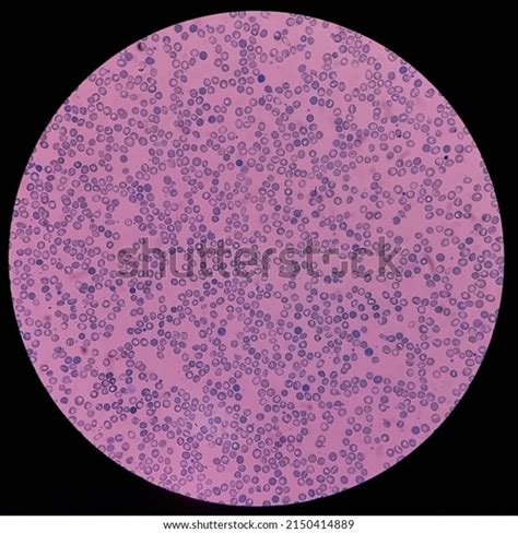 Close View Reticulocyte Count Under Microscope Foto Stock 2150414889 Shutterstock