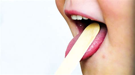 Amigdalitis Y Causas Comunes