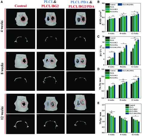 Bone Regeneration In A Rat Calvarial Bone Defect Model A Typical 3d Download Scientific