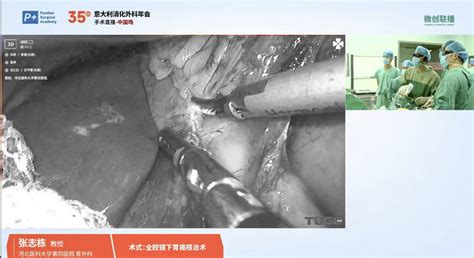 向世界展示四院技术！张志栋教授受邀在意大利消化外科年会作手术演示 河北医科大学第四医院