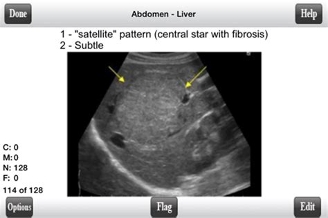 Arrt Sonography Ultrasound Flashcards Lite For Mac —