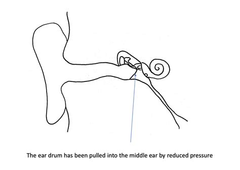 How To Draw Eardrum