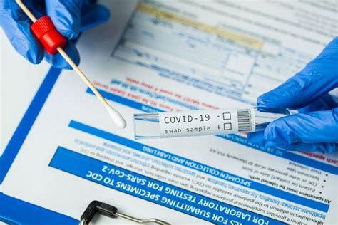 Foto Berapa Biaya Rapid Test Antigen Terbaru