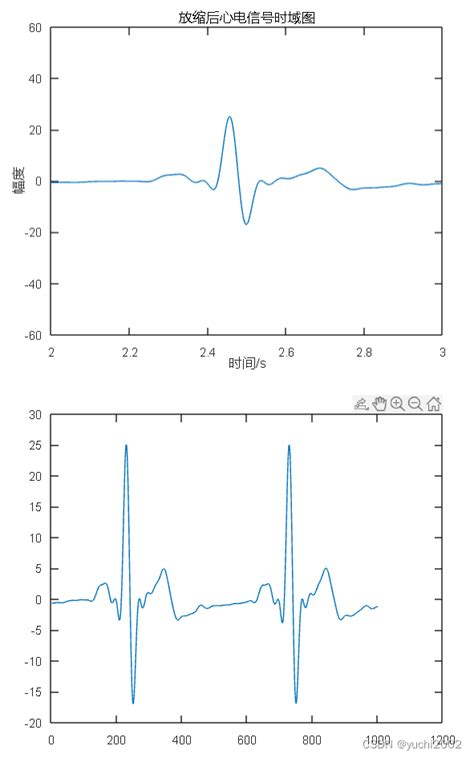 心电信号分析与处理 Csdn博客