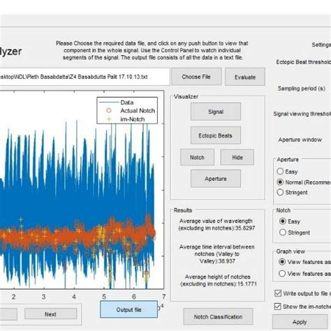 Pwa Ppg Waveform Analyser Gui Download Scientific Diagram