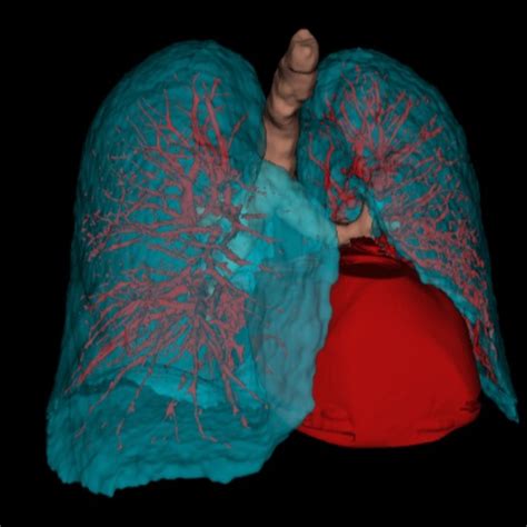 ct lung and heart and trachea segmentation kaggle