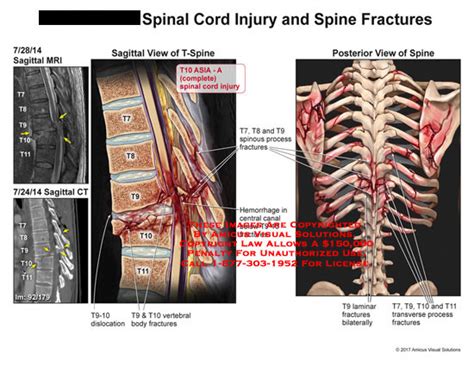 Medical Exhibits Demonstrative Aids Illustrations And Models