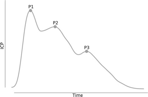 Icp Pulse Waveform Represented By Three Peaks P1 P2 P3 Download