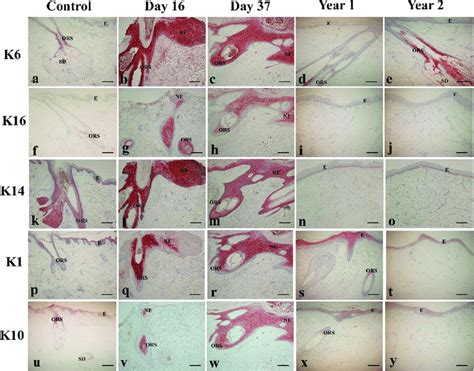 Hyperproliferation K6 And K16 Basal Epidermal K14 And Download Scientific Diagram