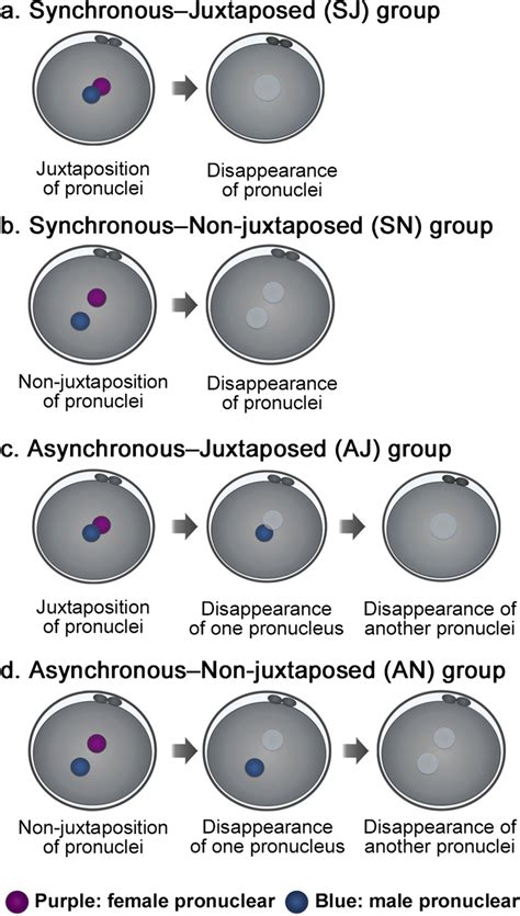 Definition Of Abnormal Pronuclei Breakdown Pnbd A The Fertilised