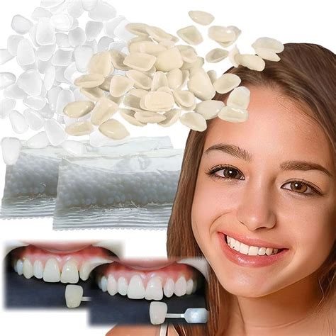 Temporary Tooth Repair Kit Thermal Fitting Beads Granules And Fake
