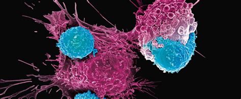 Car T Cell Therapies Now Targeting Solid Tumors Medelis