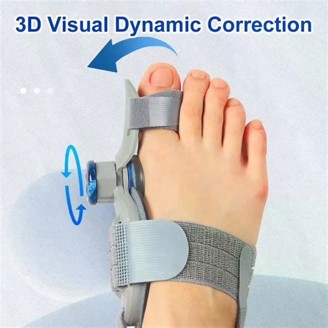 How To Choose The Best Toe Correction Brace For Your Foot Health