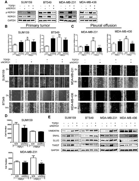 Ndrg1 Pleiotropic Activity Depends On The Origin Of Tumor Cells And