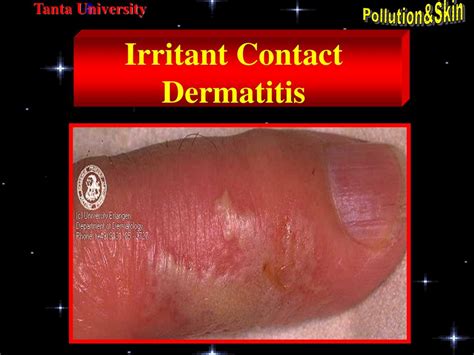 Ppt The Impact Of Pollution On Skin Health An In Depth Analysis By