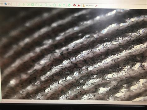 Artists Fingertip Under Weak Microscope Worked For 2h On A Pencil