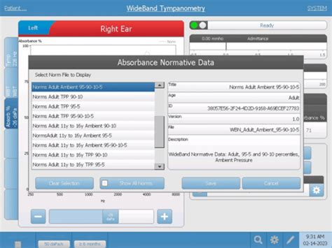 Implementation And Interpretation Of Wideband Tympanometry The