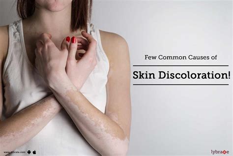 Few Common Causes Of Skin Discoloration By Dr Himanshu Singhal